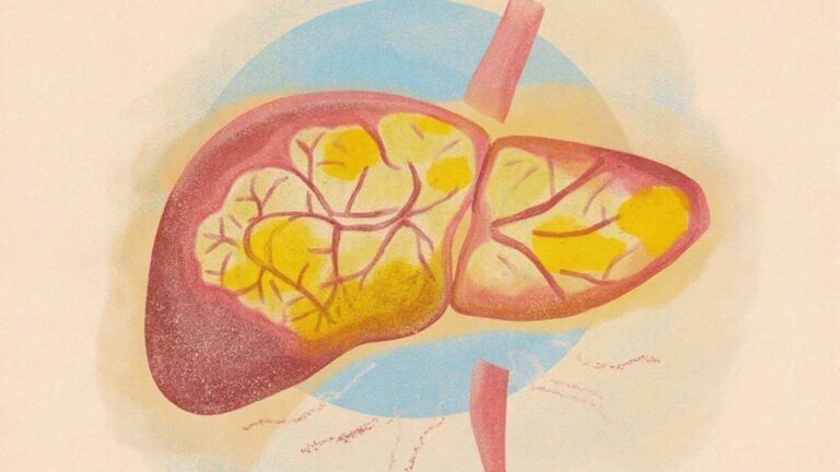 Autoimmune Hepatitis | Symptoms, Types & Treatments